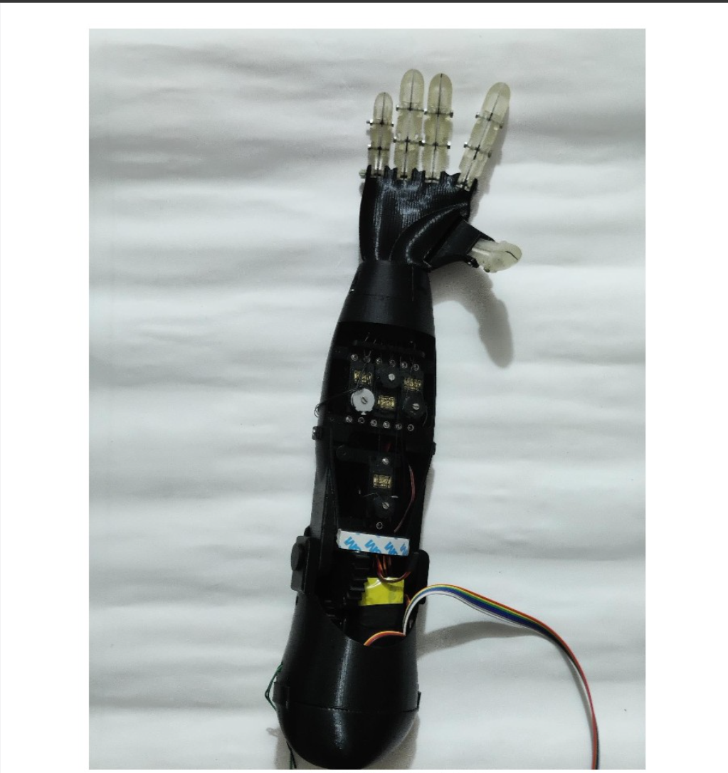 Prosthetic Arm